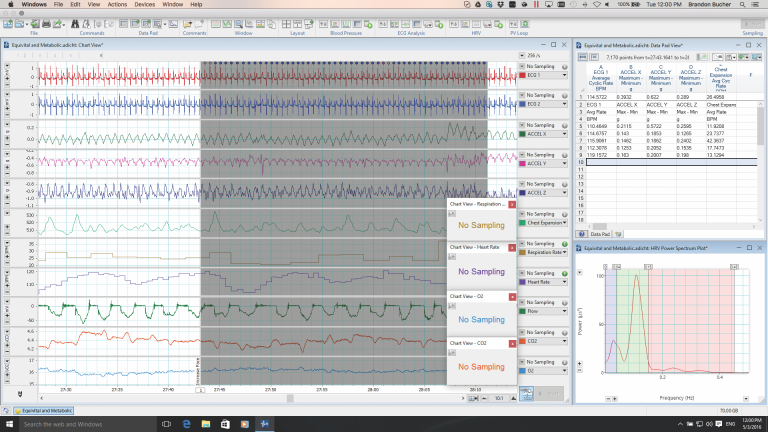 Wireless Physiological Monitoring | ADInstruments